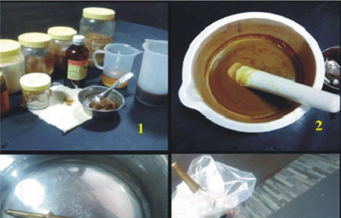 VIRECHANA – (MEDICATED PURGATION THERAPY)