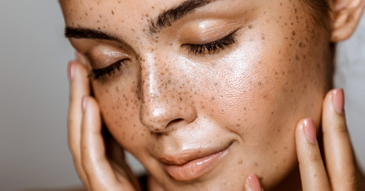 What Are the Most Common Skin Problems?